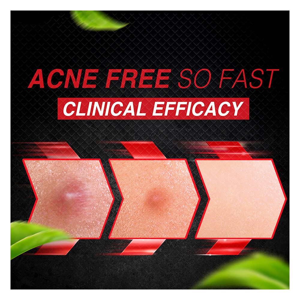 Purchase Garnier Men Acno Fight Anti-Pimple Face Wash 100g Online at ...