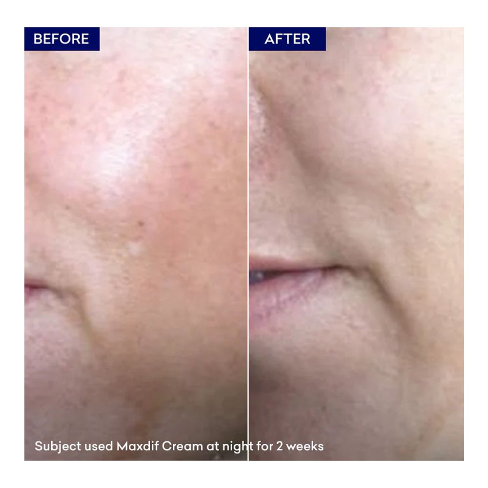 Buy Jen Pharm Maxdif Skin Brightening Cream, 40g Online at Special ...