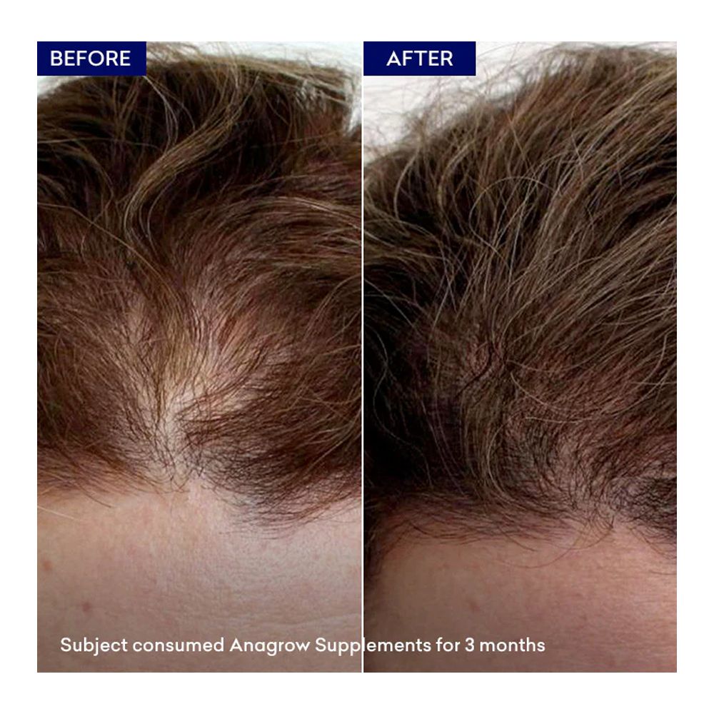 Buy Jen Pharm Anagrow Biotin 10000mcg With Keratin, Soft Gel Capsules ...