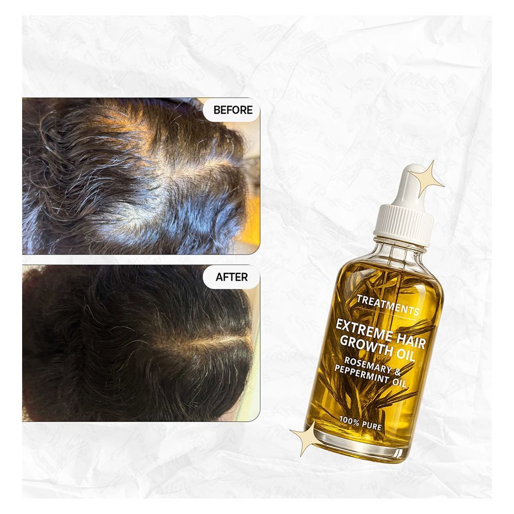 Treatments Extreme Hair Growth Oil Rosemary & Pepperment Oil, For Hair ...