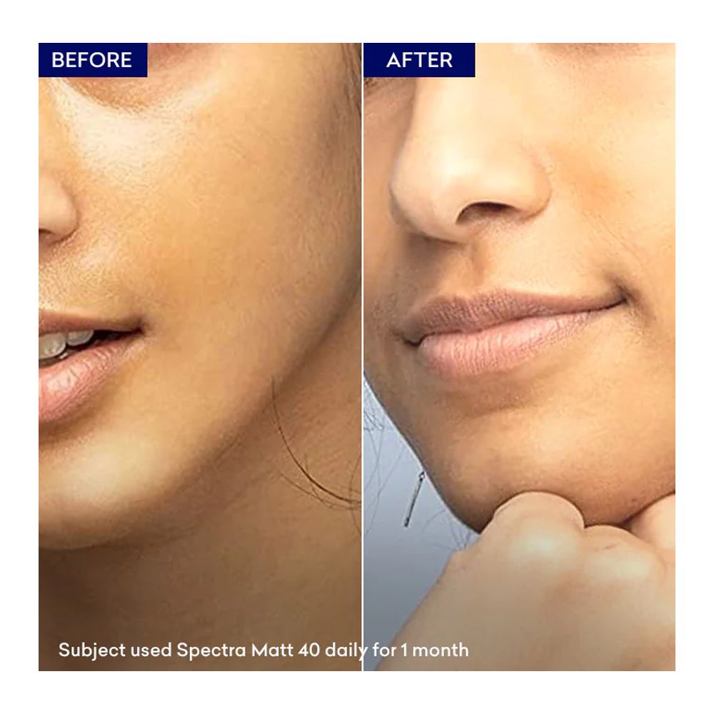 Order Jen Pharm Spectra Matt Sunblock SPF-40, For Oily/Acne Prone ...