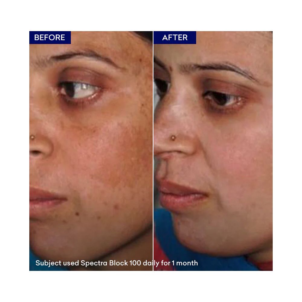 Buy Jen Pharm Spectra Sun Block Max SPF-100, 40g Online at Best Price ...